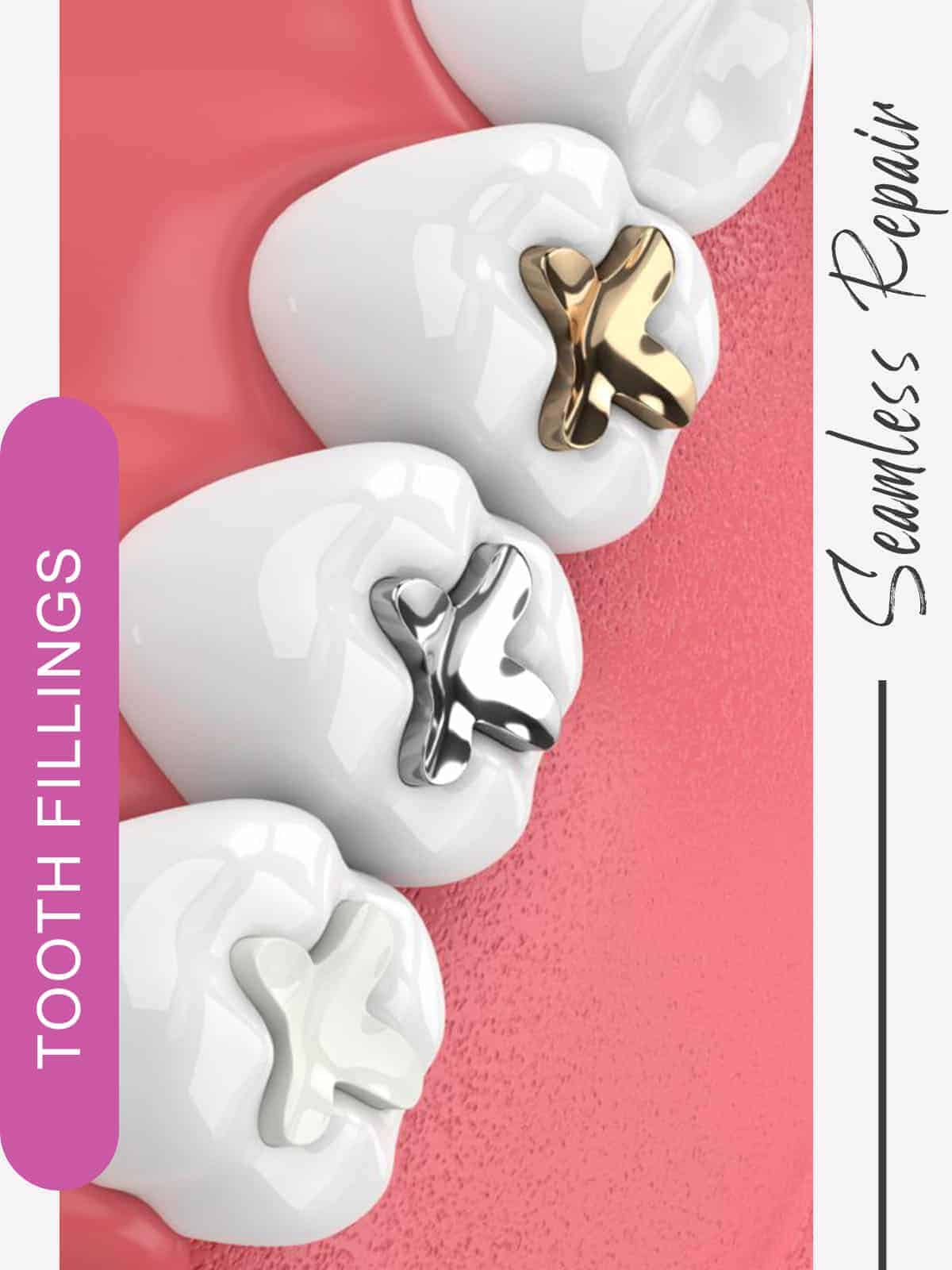 Tooth Fillings in Turkey: Expert Care, Flawless Finish